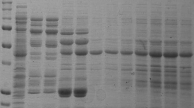 Coomassie Brilliant Blue Staining | ベルトールドジャパン株式会社